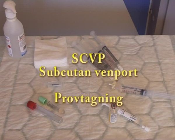 Streamio - SCVP provtagning